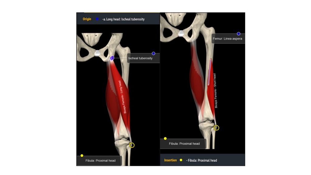 Musculatura Posterior da coxa - Isquiotibiais