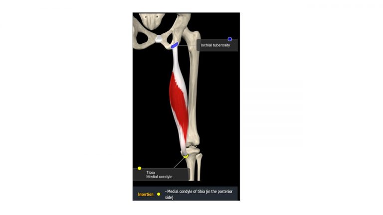 Musculatura Posterior da coxa - Isquiotibiais