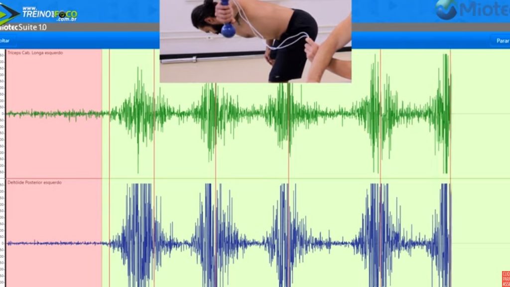 Crucifixo Invertido - Qual técnica produz maior ativação do deltoide ...